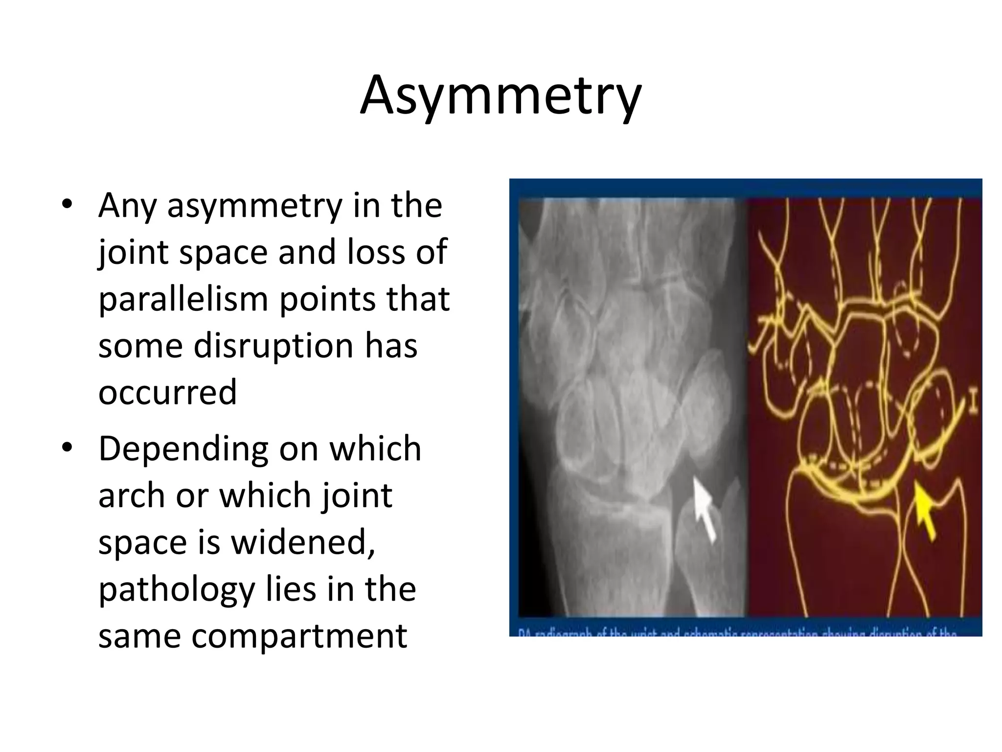 Imaging of wrist joint | PPTX