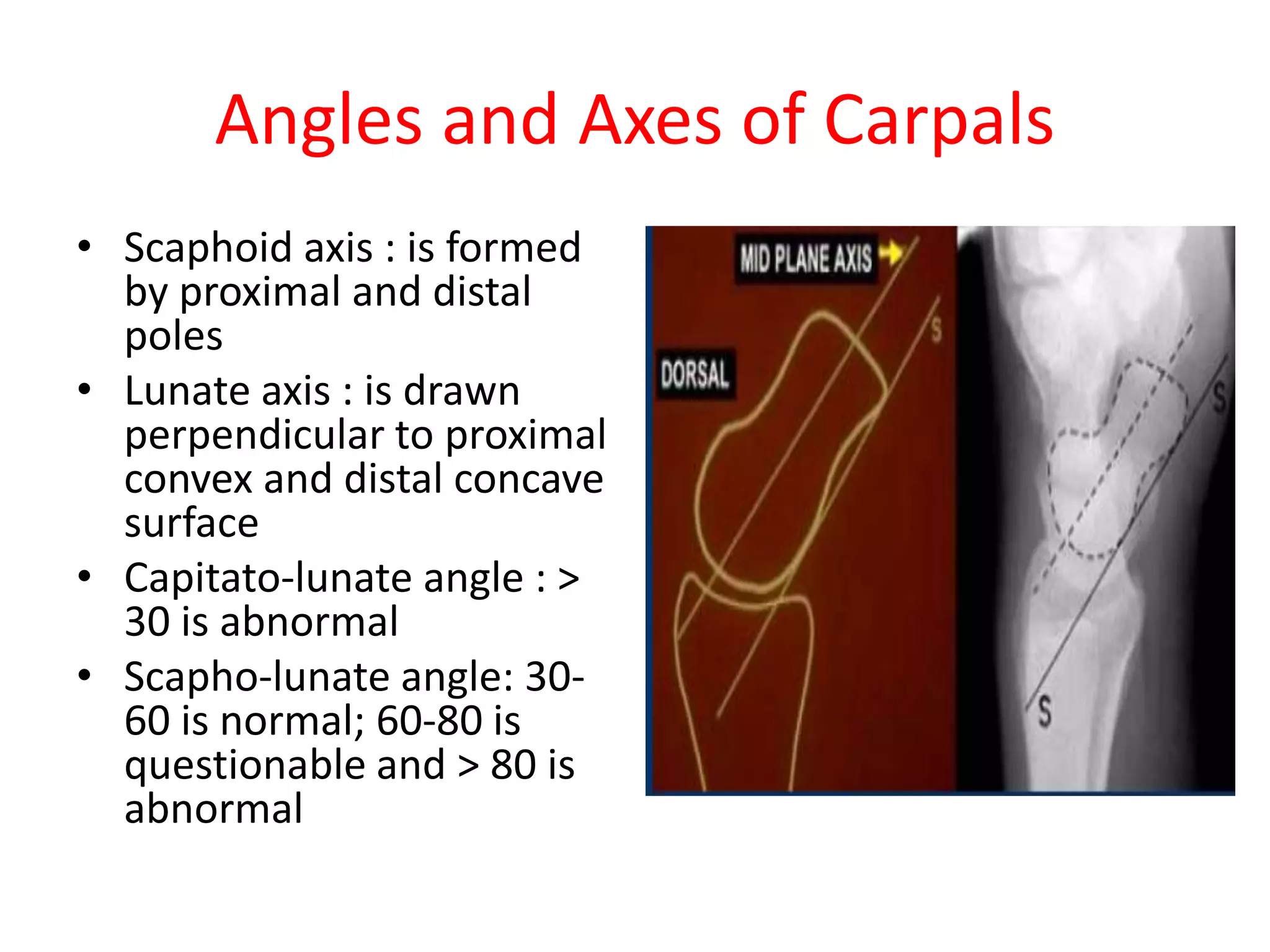 Imaging of wrist joint | PPTX
