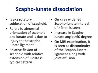 Imaging of wrist joint | PPTX