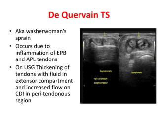 Imaging of wrist joint | PPTX