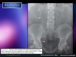 Imaging in urology: part 1 kub & ivp | PDF