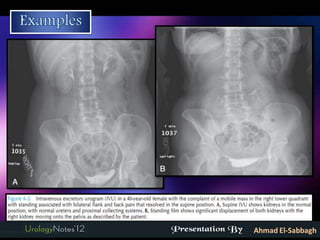 Imaging in urology: part 1 kub & ivp | PDF