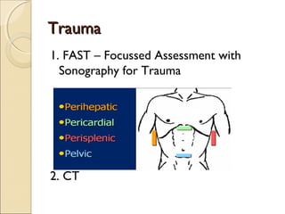 Imaging in acute abdominal pain | PPT