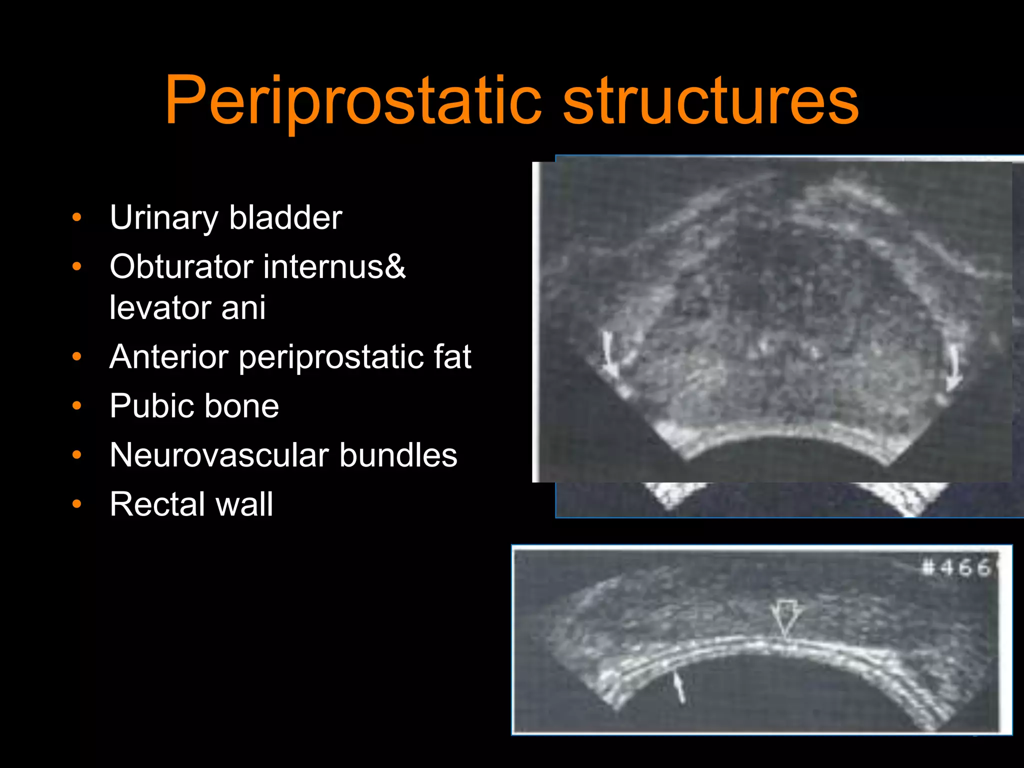 Imaging prostatitis ,urethritis Dr Ahmed Esawy | PDF