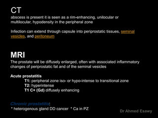Imaging prostatitis ,urethritis Dr Ahmed Esawy | PDF