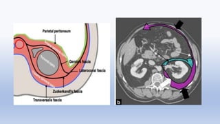 Radiological Imaging of Retroperitoneum.pptx