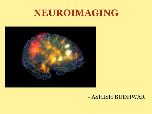 Imaging techniques | PPTX | Brain and Nervous System Disorders | Diseases and Conditions