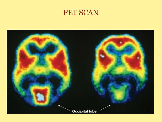 Imaging techniques | PPTX | Brain and Nervous System Disorders | Diseases and Conditions