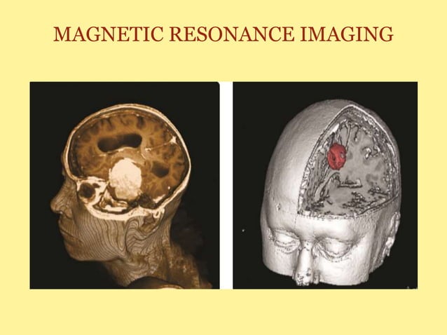Imaging techniques | PPTX | Brain and Nervous System Disorders | Diseases and Conditions