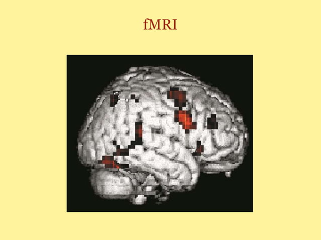 Imaging techniques | PPTX | Brain and Nervous System Disorders | Diseases and Conditions