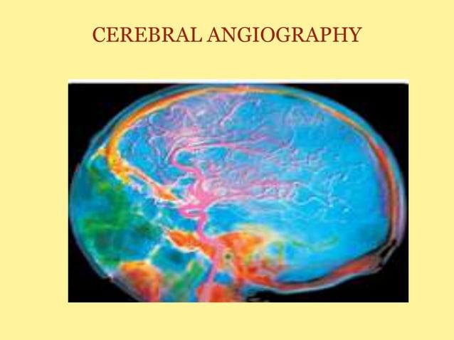 Imaging techniques | PPTX | Brain and Nervous System Disorders | Diseases and Conditions