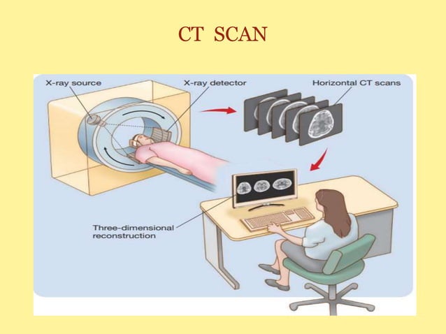 Imaging techniques | PPTX | Brain and Nervous System Disorders | Diseases and Conditions