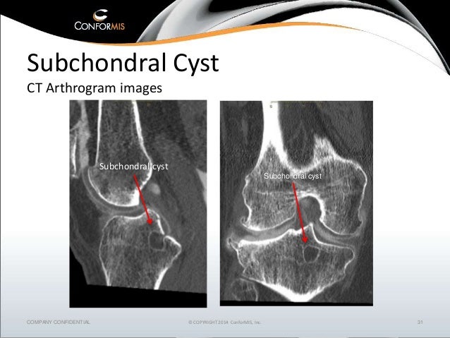 Imaging technologist training the osteoarthritic knee 2014
