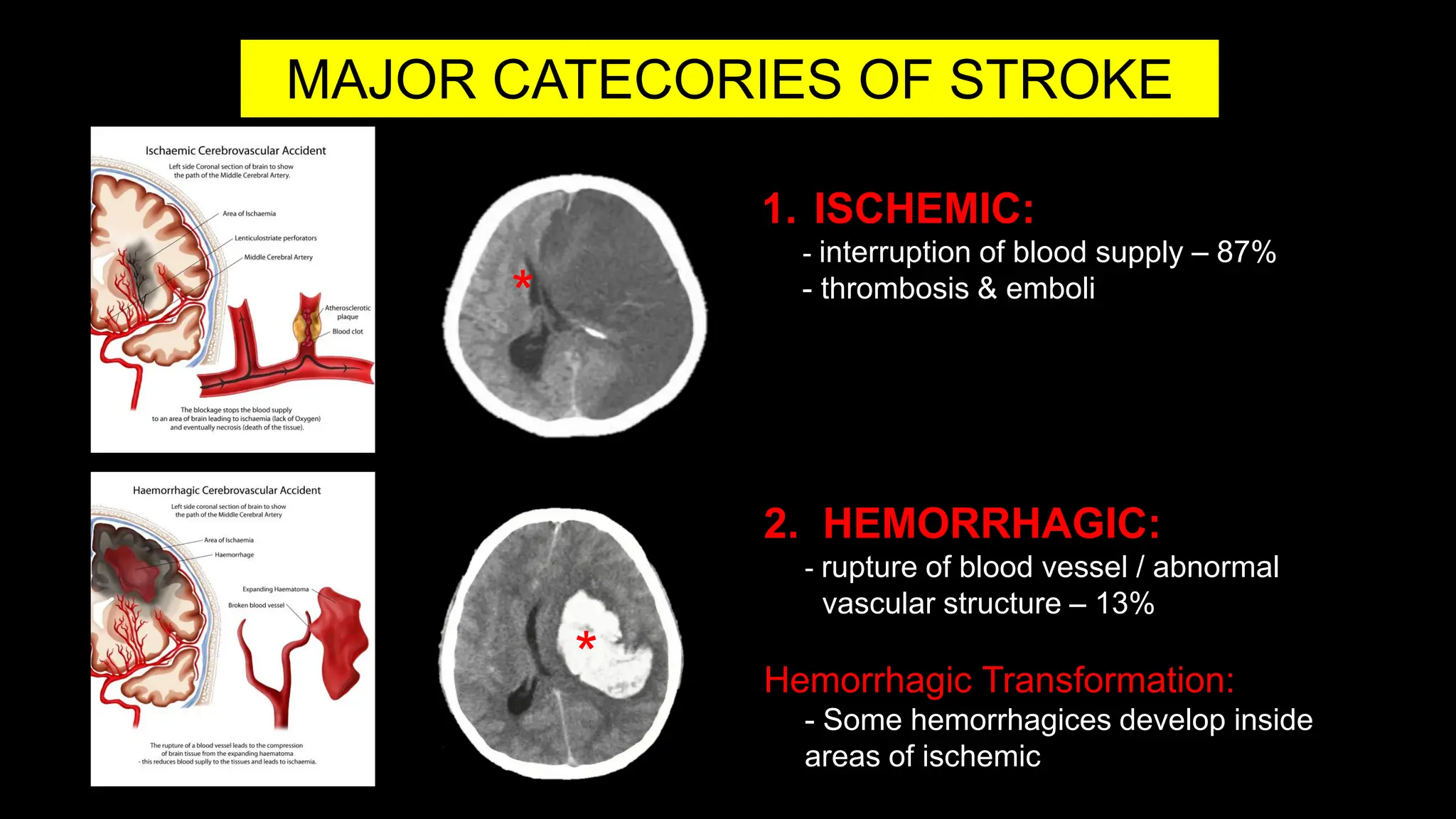 Imaging Technology for Stroke.pdf