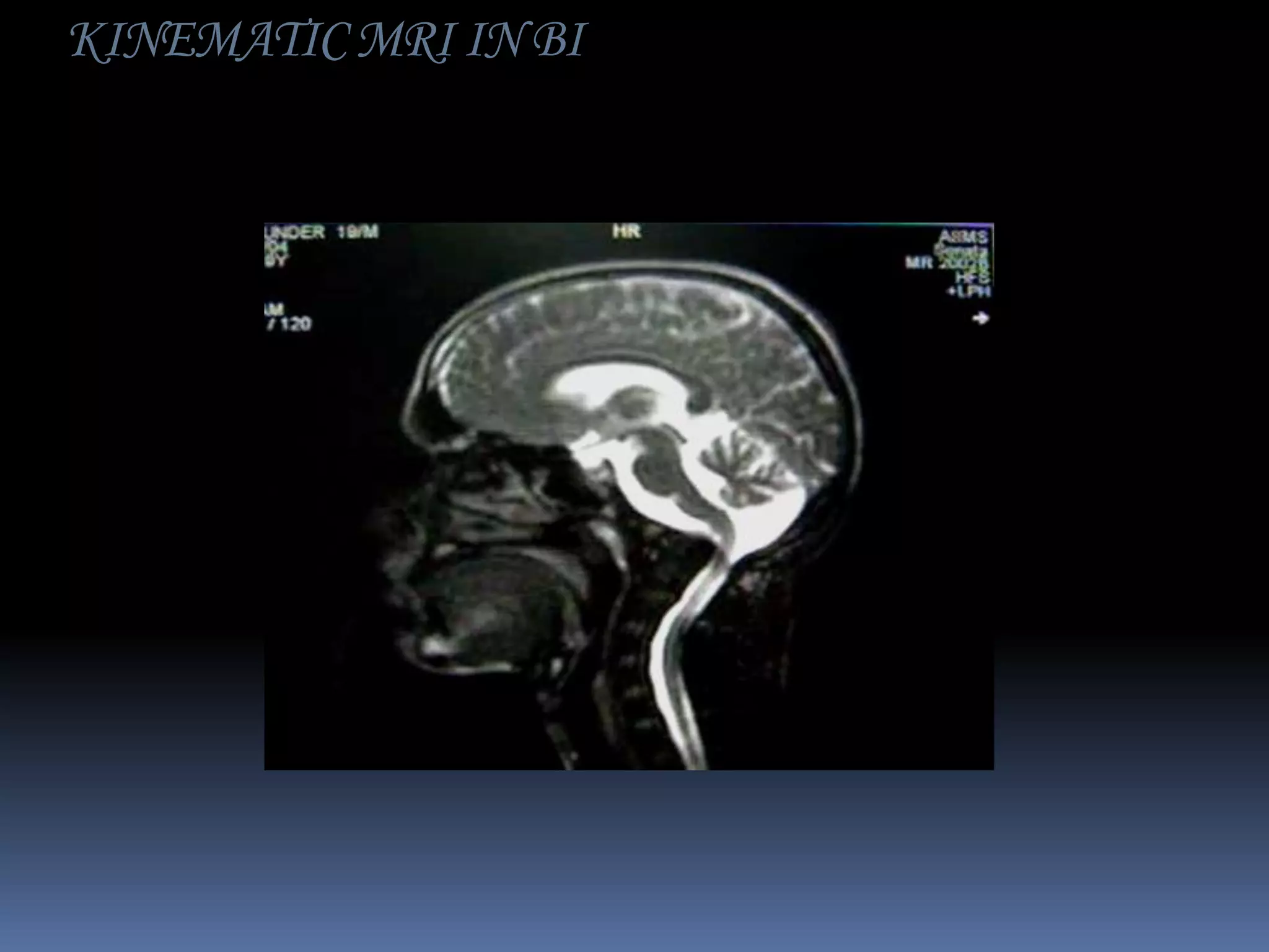 Imaging the cv junction.part 1. himadri s das | PPTX