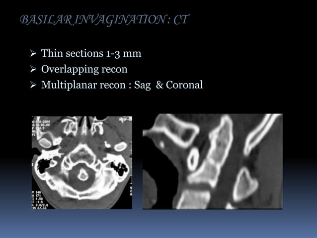 Imaging the cv junction.part 1. himadri s das | PPT