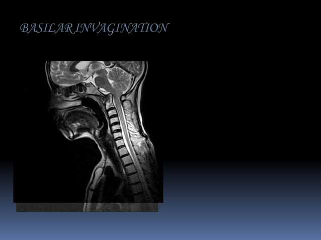 Imaging the cv junction.part 1. himadri s das | PPTX
