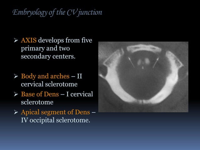 Imaging the cv junction.part 1. himadri s das | PPT