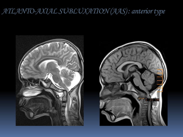 Imaging the cv junction.part 1. himadri s das | PPTX