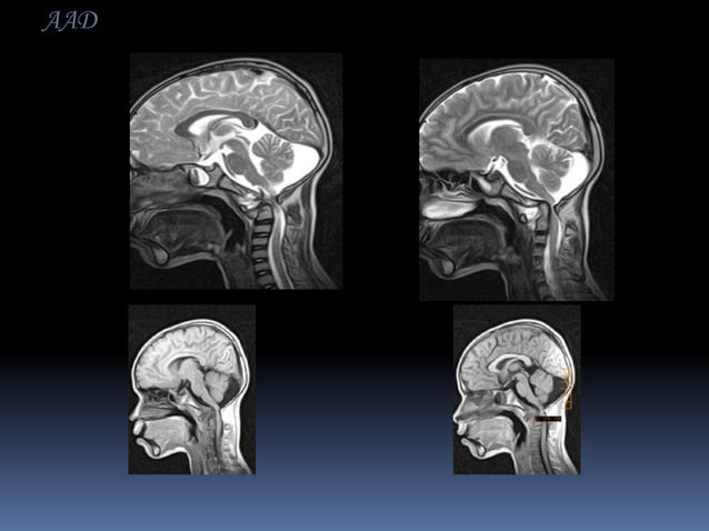 Imaging the cv junction.part 1. himadri s das | PPTX