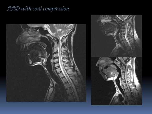 Imaging the cv junction.part 1. himadri s das | PPTX