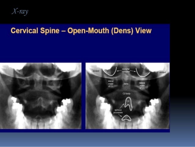 Imaging The Cv Junction Part 1 Himadri S Das