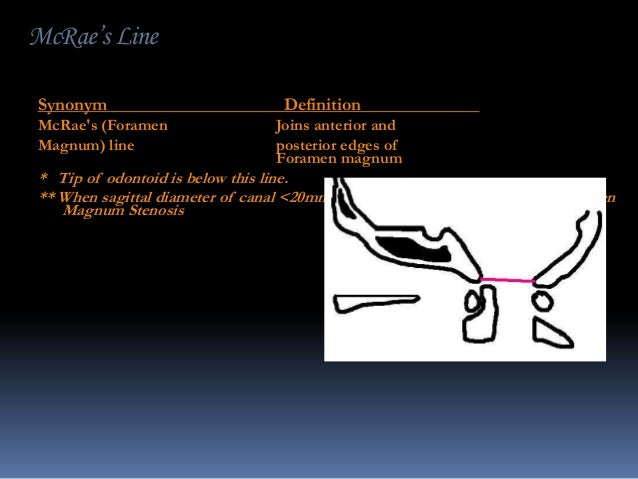 Imaging the cv junction.part 1. himadri s das