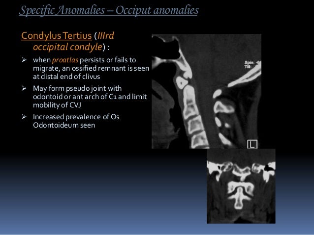 Imaging the cv junction.part 1. himadri s das