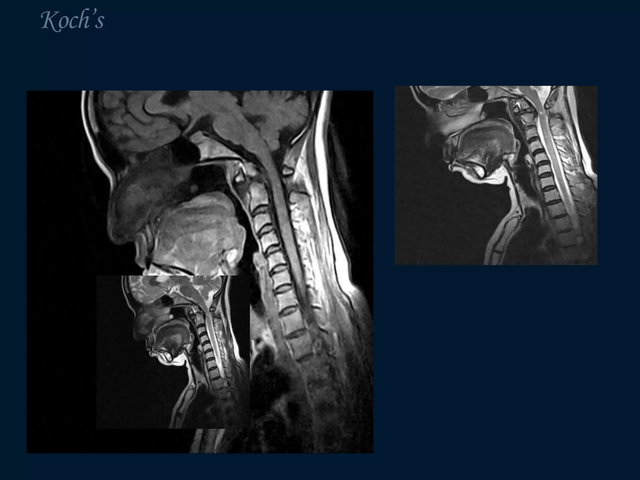 Imaging the cv junction.part 2. himadri s das | PPTX