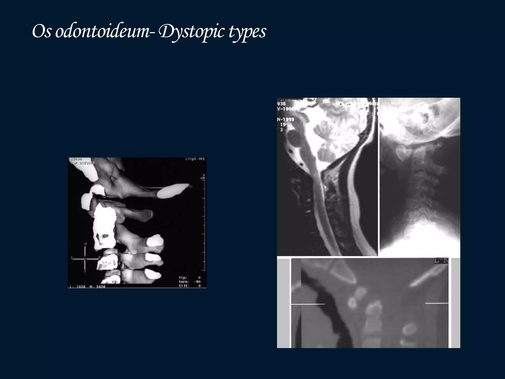 Imaging the cv junction.part 2. himadri s das | PPTX