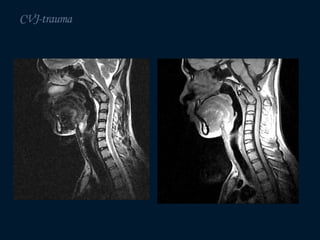 Imaging the cv junction.part 2. himadri s das | PPTX