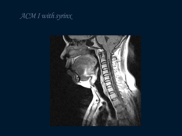 Imaging the cv junction.part 2. himadri s das | PPTX | Death, Injury ...