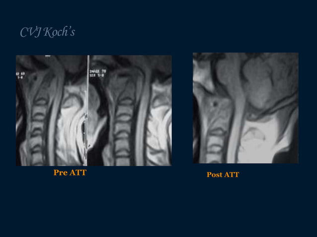 Imaging the cv junction.part 2. himadri s das | PPTX | Death, Injury ...