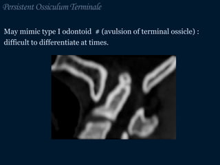 Imaging the cv junction.part 2. himadri s das | PPT