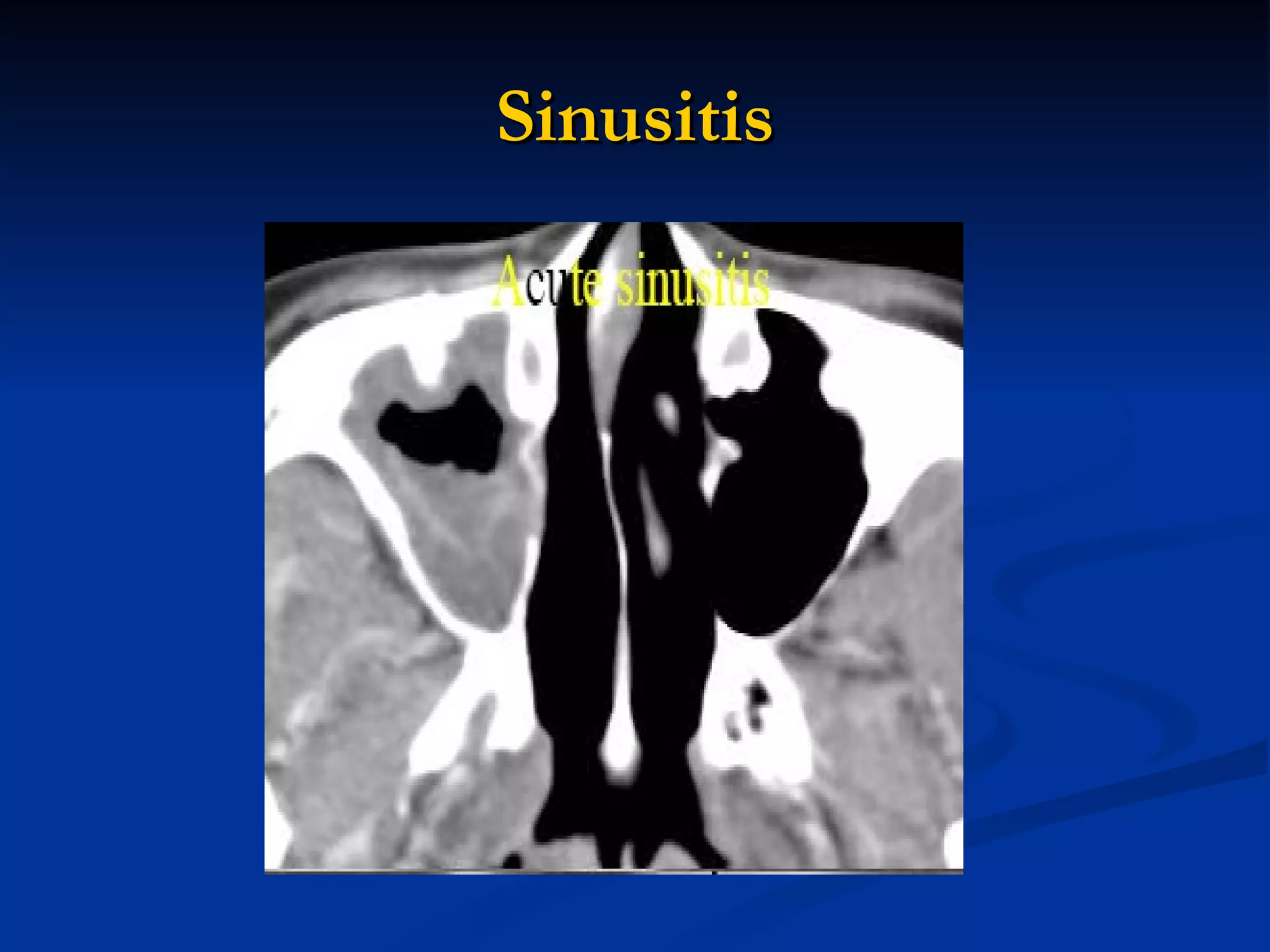Imaging The Paranasal Sinuses. Iria 2008 | PPT