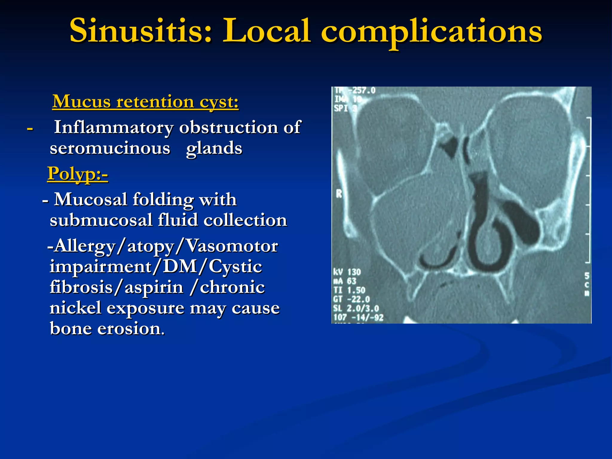 Imaging The Paranasal Sinuses. Iria 2008 | PPT