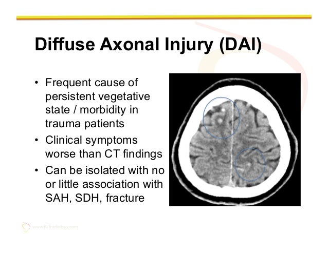 Imaging of Traumatic Brain Injury