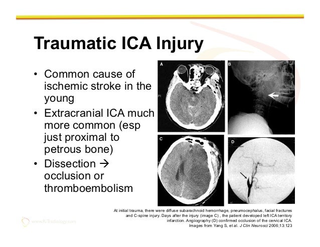 Imaging of Traumatic Brain Injury