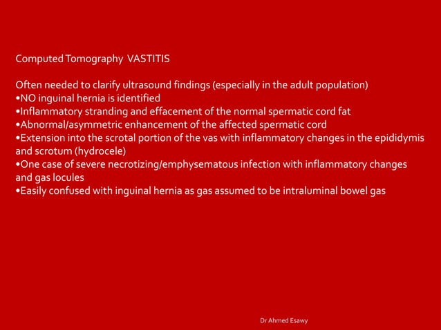 Imaging vastitis differentitis funiculitis seminal vesiculitis Dr Ahmed ...
