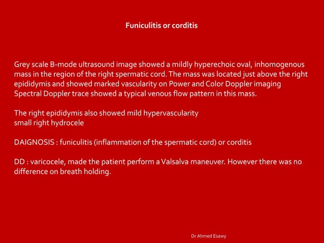 Imaging vastitis differentitis funiculitis seminal vesiculitis Dr Ahmed ...