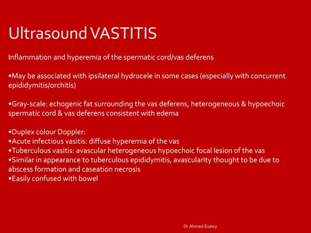 Imaging vastitis differentitis funiculitis seminal vesiculitis Dr Ahmed ...