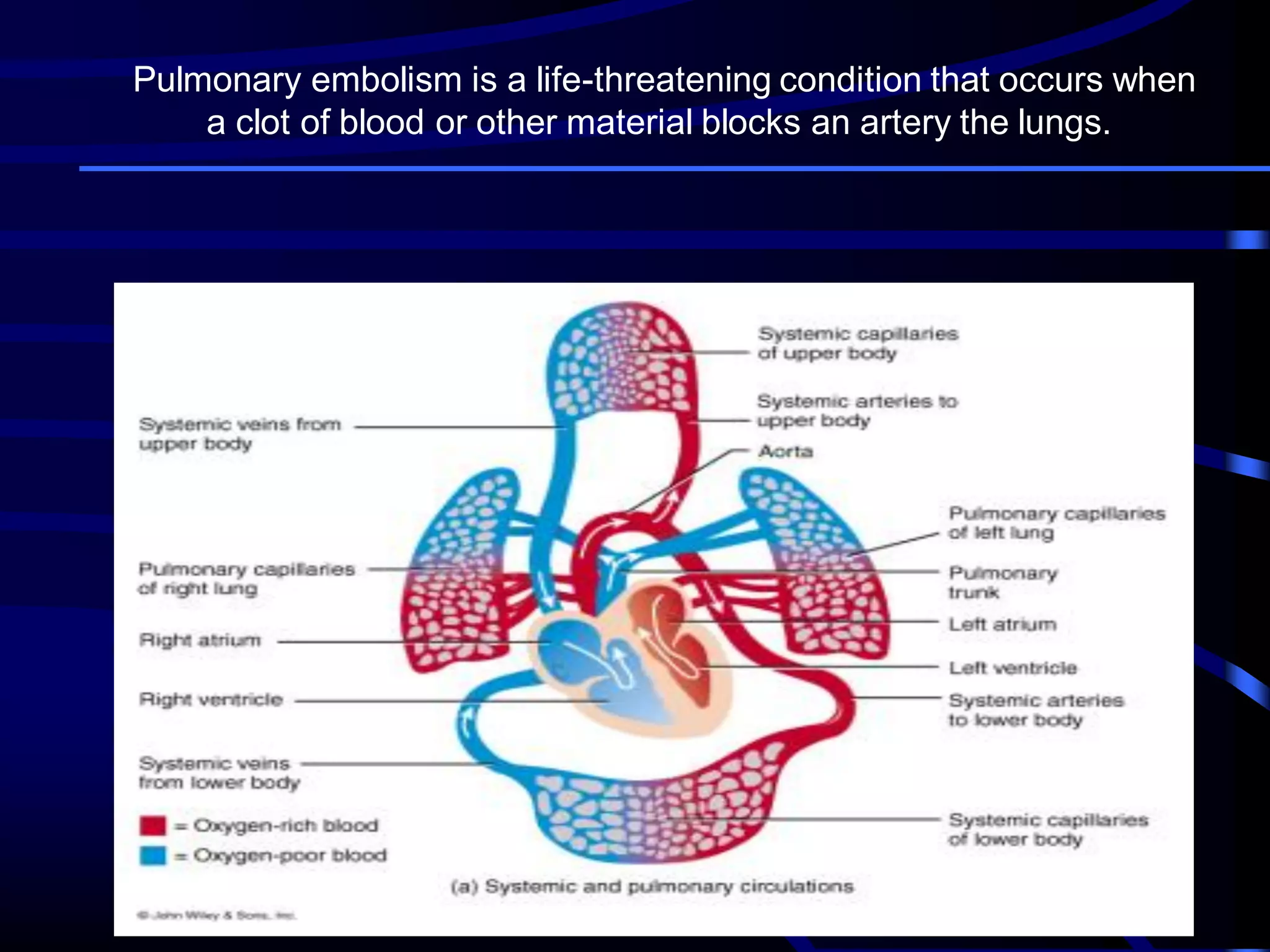 Imaging of Pulmonary Embolism | PDF | Lung and Respiratory Health ...