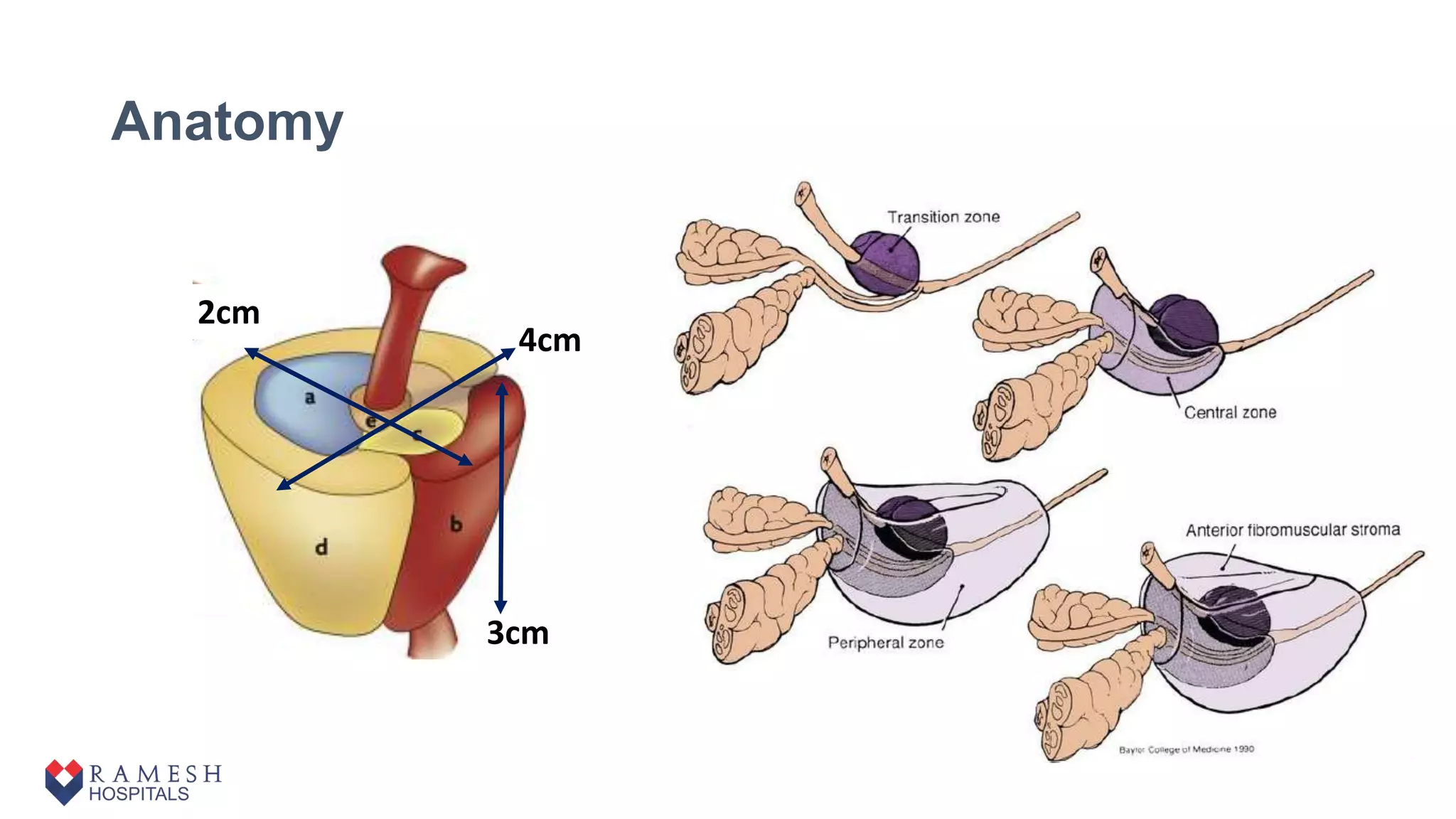 diagnosis and outline of management of localized prostate cancer for ...