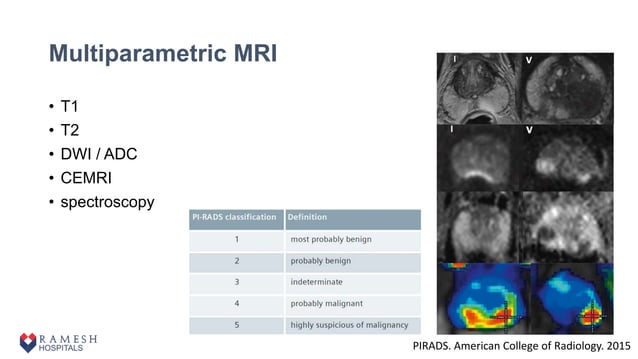 diagnosis and outline of management of localized prostate cancer for ...