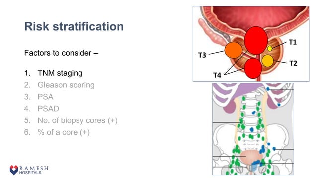 diagnosis and outline of management of localized prostate cancer for ...