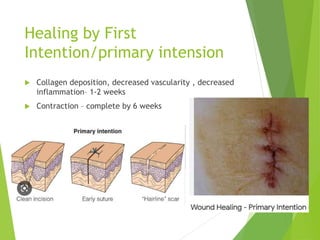 HEALING_AND_REPAIR_-_MBchB_2.1p king Caesar University | PPT