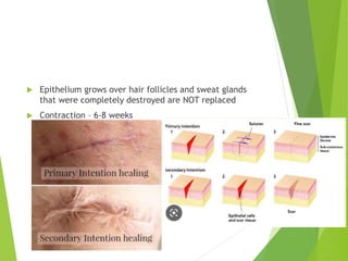 HEALING_AND_REPAIR_-_MBchB_2.1p king Caesar University | PPT