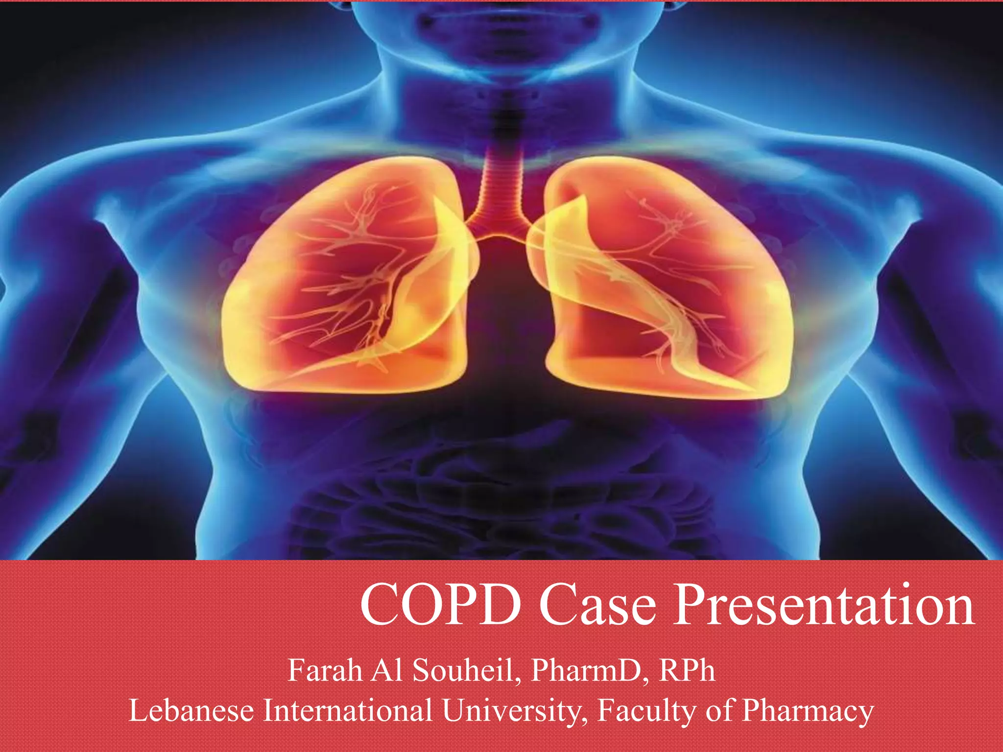 COPD exacerbation case presentation and disease overview | PPTX