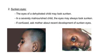 IMCI-Diarrhoea.pptx a slide about diarrhoea.. | PPTX