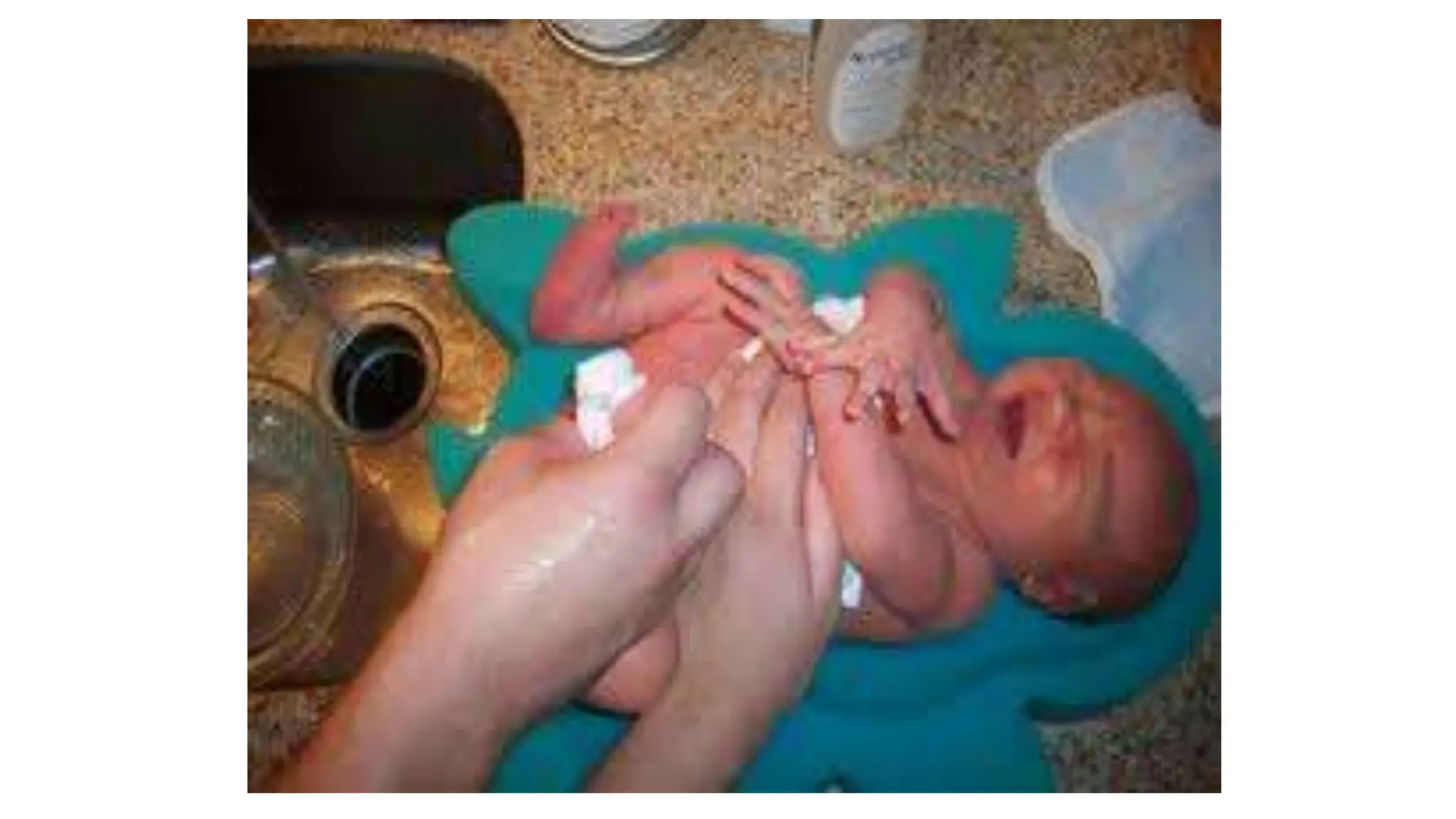 IMCI LECTURE PRESENTATION 1.pptx by Ronald | PPTX